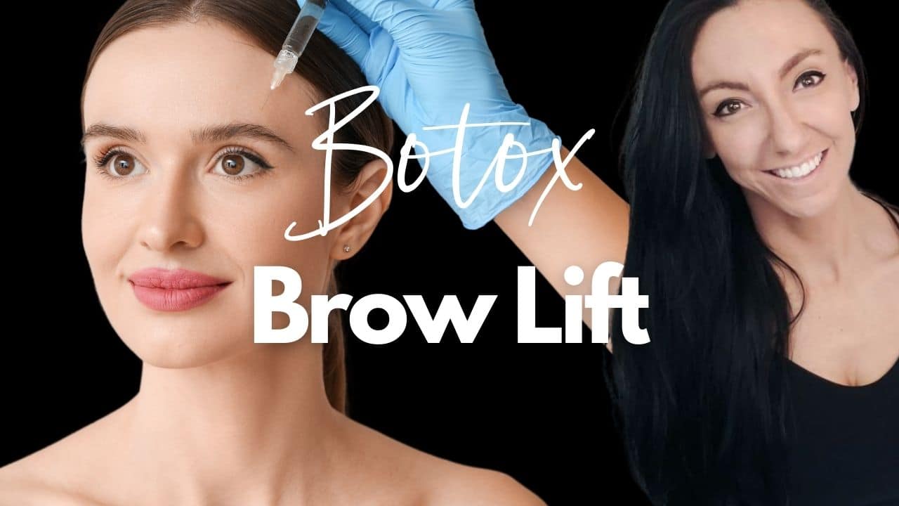 Botox Brow Lift | Sparkle Lifestyle & Medispa